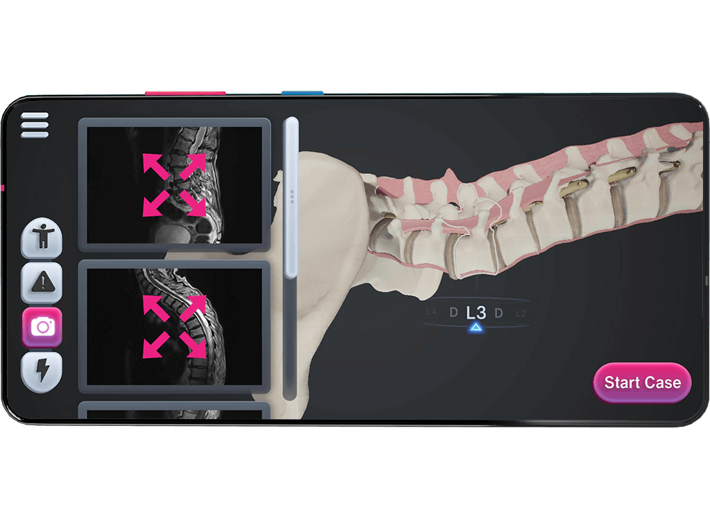Xplore Spine | Brainlab